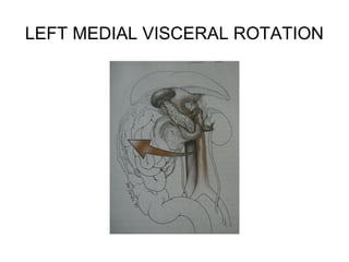 Abdominal vascular injuries | PPT