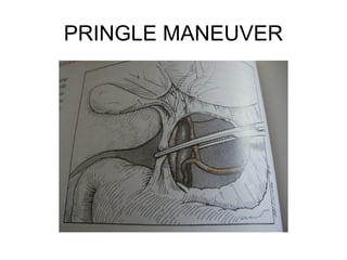 Abdominal vascular injuries | PPT