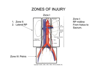 Abdominal vascular injuries | PPT