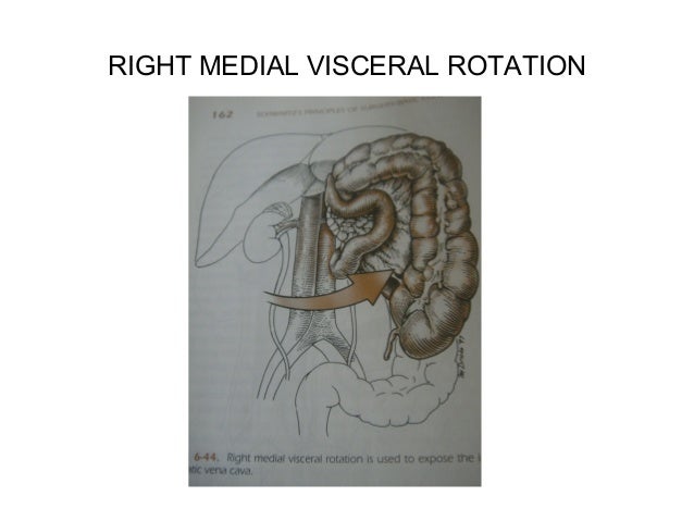 Abdominal vascular injuries