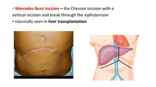 Abdominal Wall.pptx