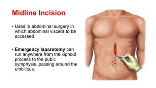 Abdominal Wall.pptx
