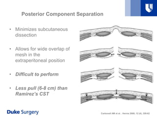 Abdominal wall anatomy with respect to understanding component ...