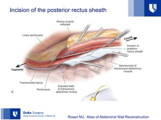 Abdominal wall anatomy with respect to understanding component ...