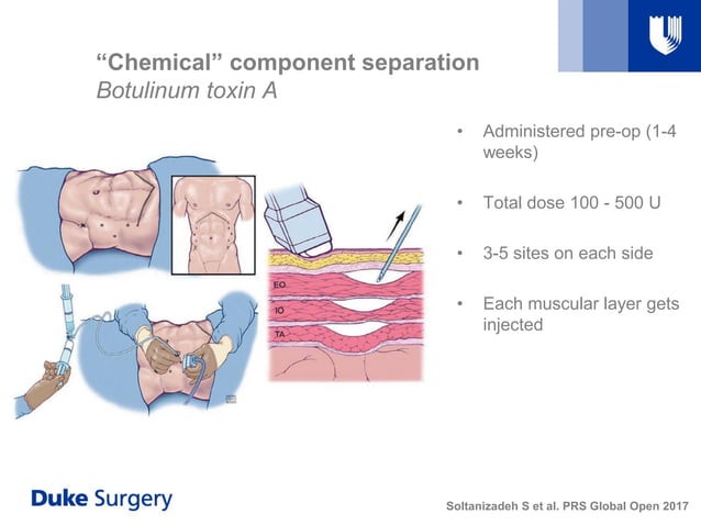 Abdominal wall anatomy with respect to understanding component ...