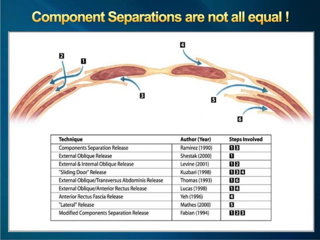 Abdominal wall anatomy with respect to understanding component separation.pdf