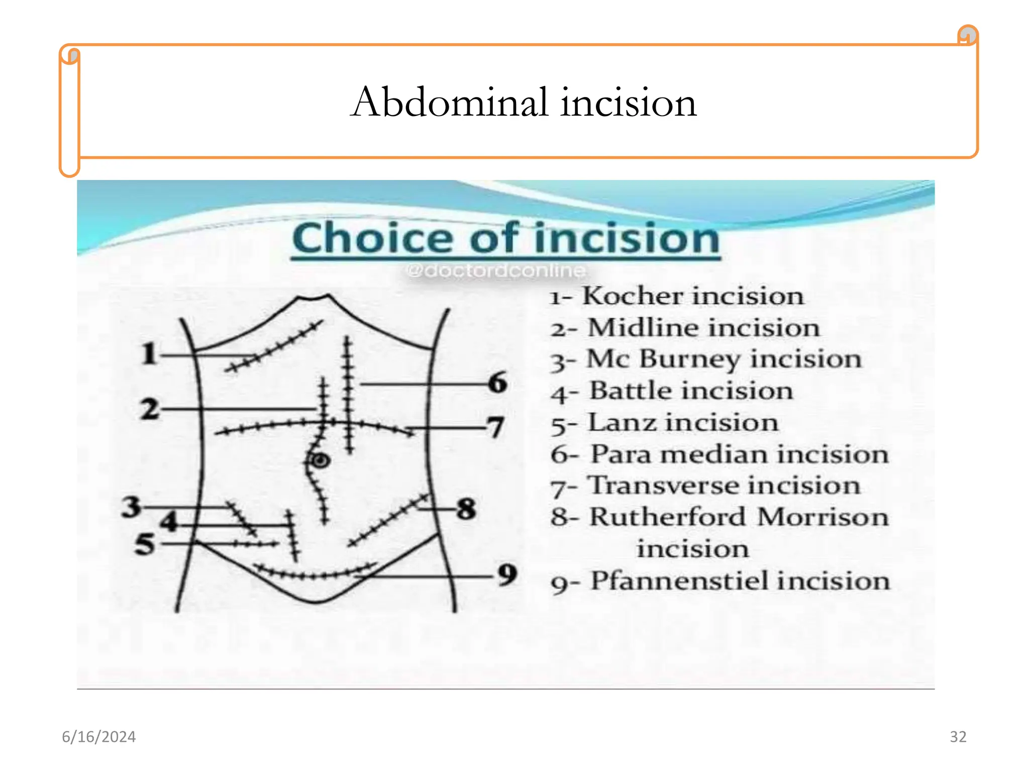 Abdominal wall and inguinal region anatomy.pptx