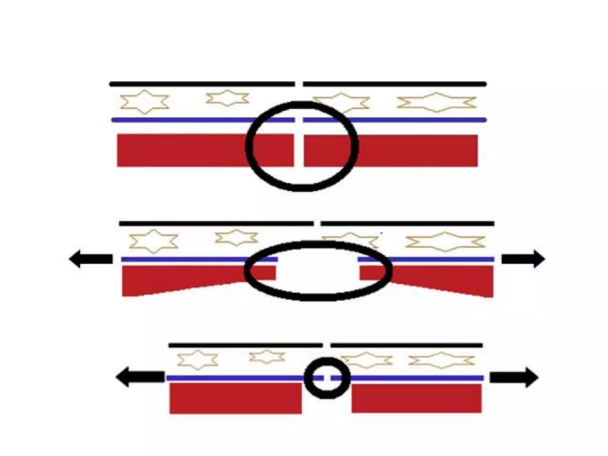 Abdominal wall closure | PPTX