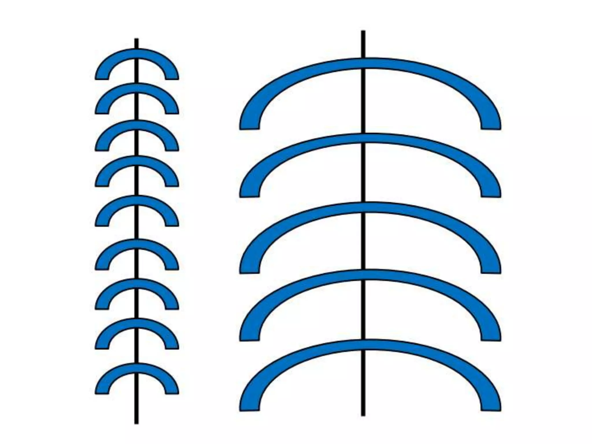 Abdominal wall closure | PPTX