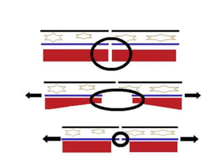 Abdominal wall closure | PPTX