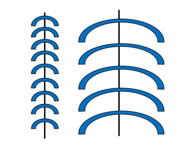 Abdominal wall closure | PPTX | Surgery | Medical Health