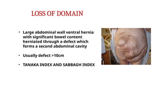 abdominal wall component separation.pptx