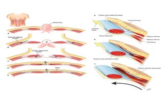abdominal wall component separation.pptx