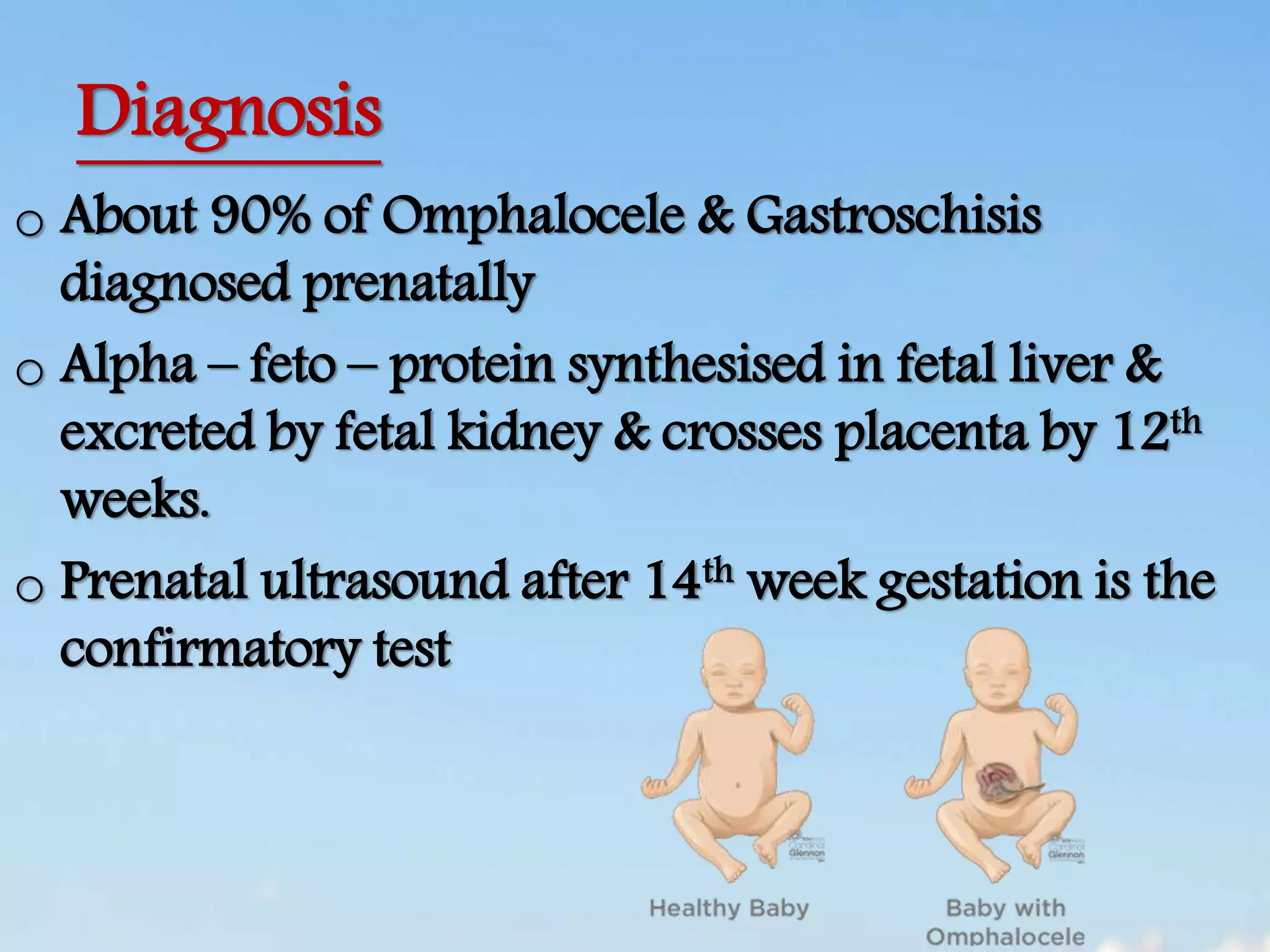 Abdominal wall defect | PPTX