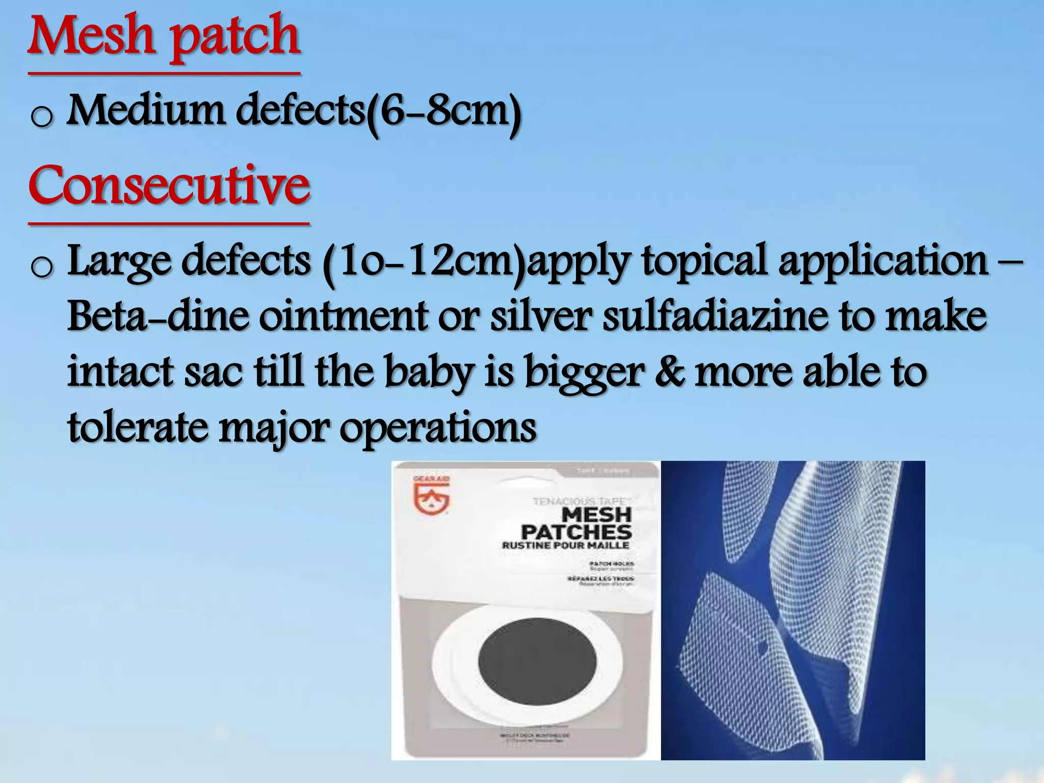 Abdominal wall defect | PPTX