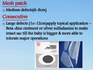 Abdominal wall defect | PPTX