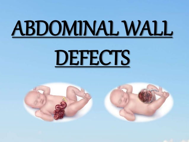 Abdominal wall defect | PPT