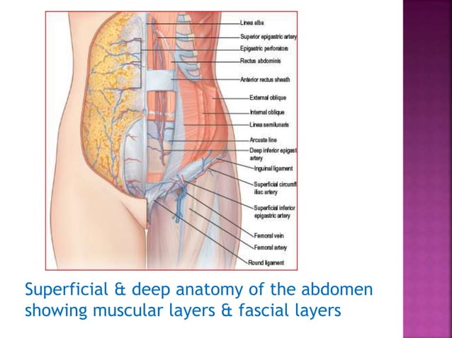 Abdominal wall defect reconstruction | PPTX
