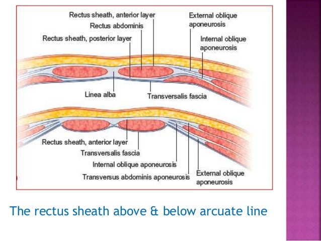 Abdominal wall defect reconstruction