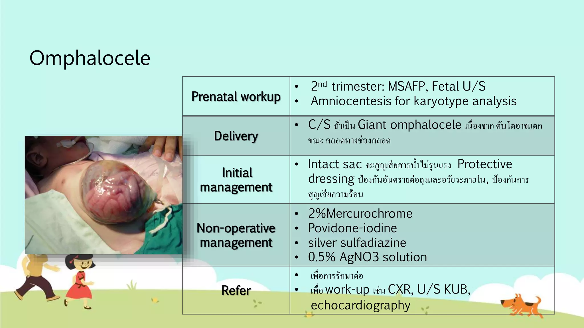 Abdominal wall defects | PPTX