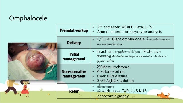Abdominal wall defects