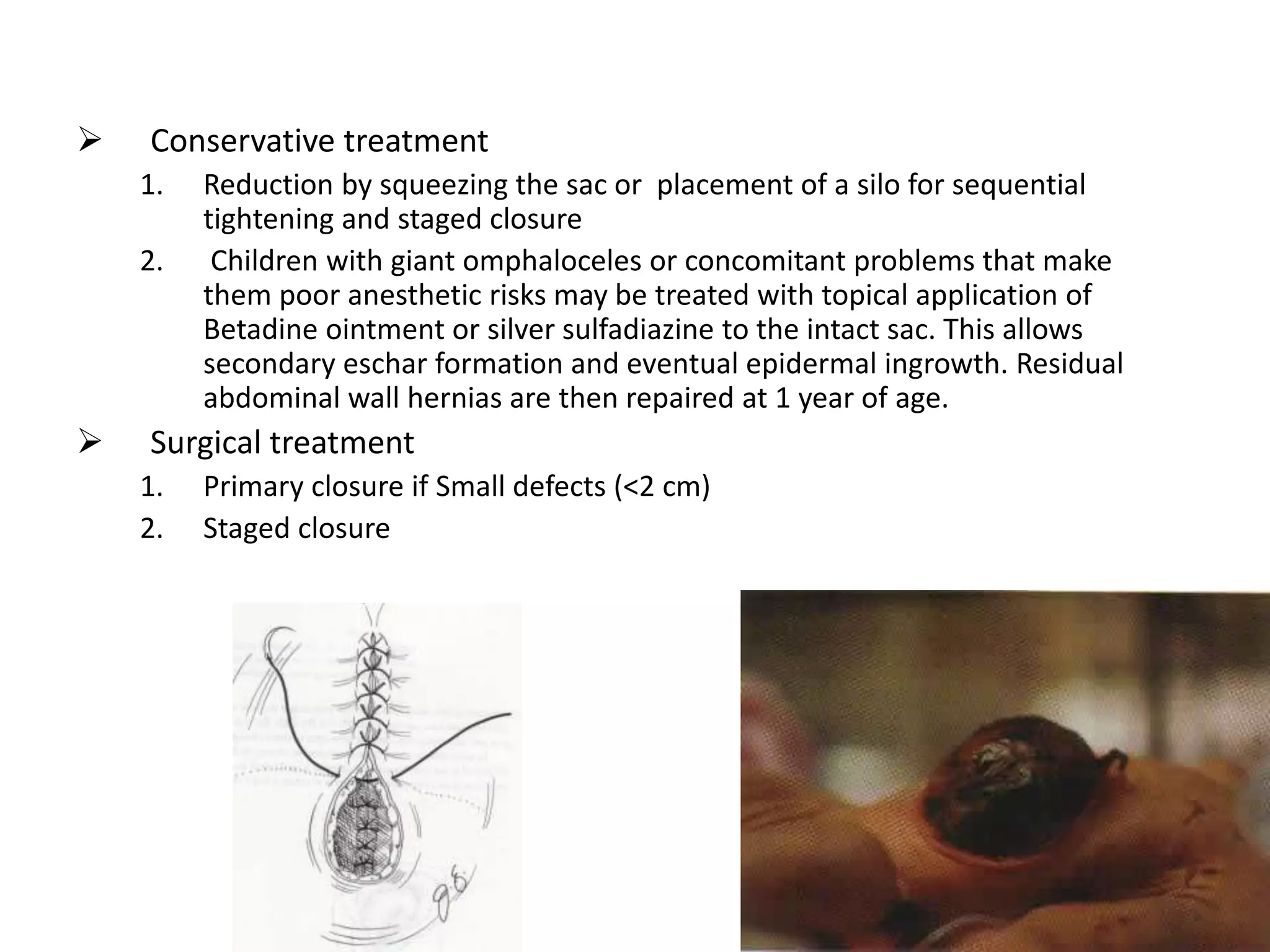 ABDOMINAL WALL DEFECTS.pptx