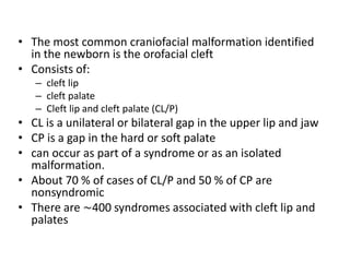 ABDOMINAL WALL DEFECTS.pptx