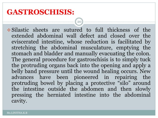 Abdominal Wall Defects Pptx