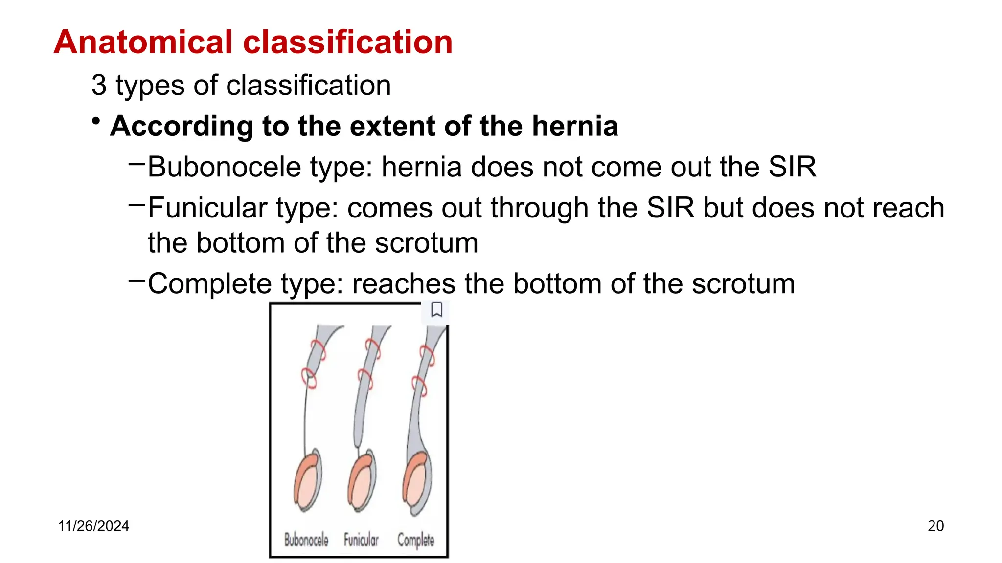 definitions, Anatomy , classifications and managements | PPT