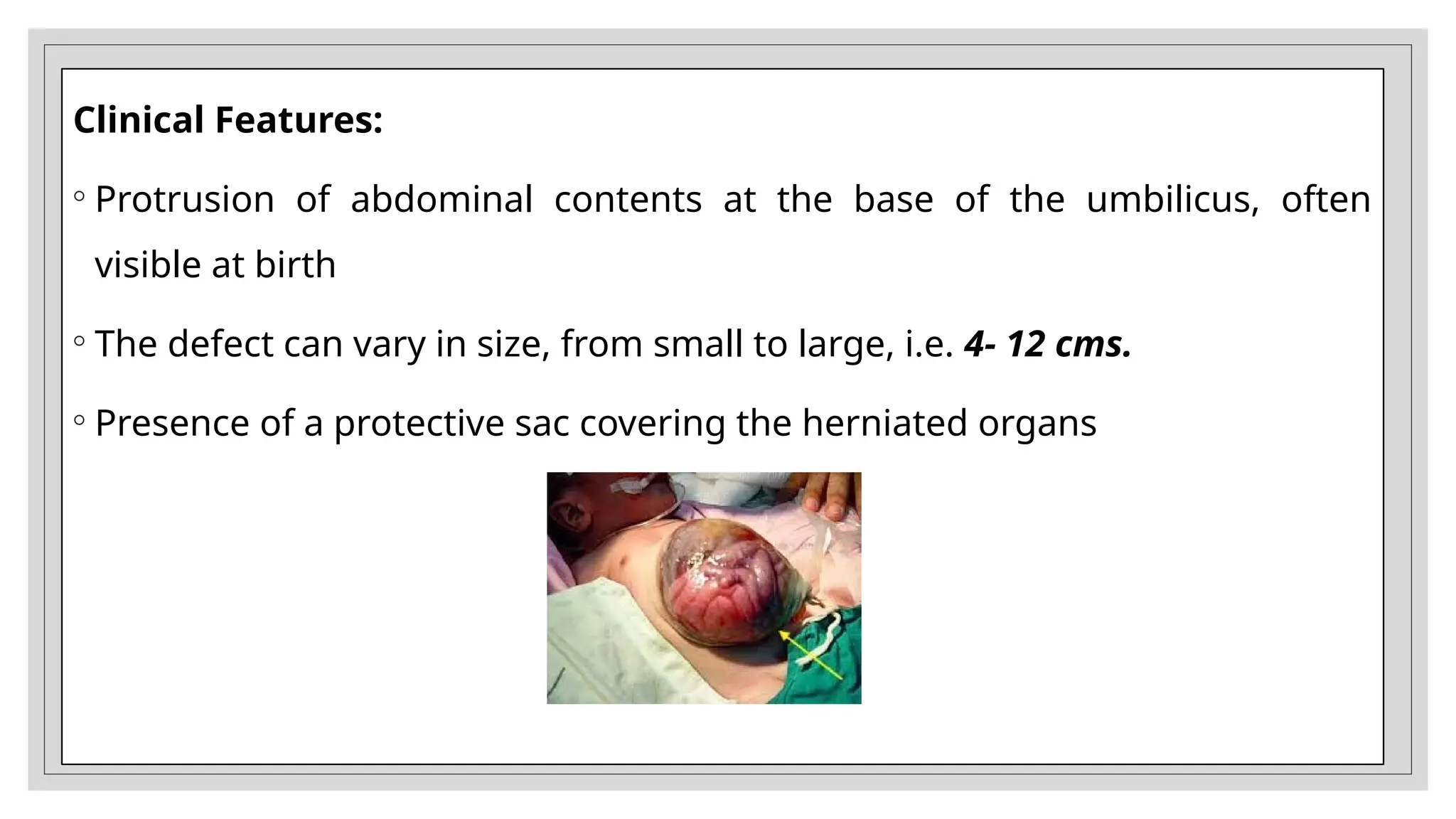 ABDOMINAL WALL DEFECTS:GASTROSCHISIS, OMPHALOCELE.pptx