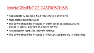 Abdominal wall defects (dr.tanvir) | PPTX