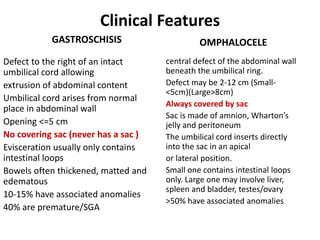 Abdominal wall defects | PPTX