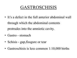 Abdominal wall defects in young children.pptx
