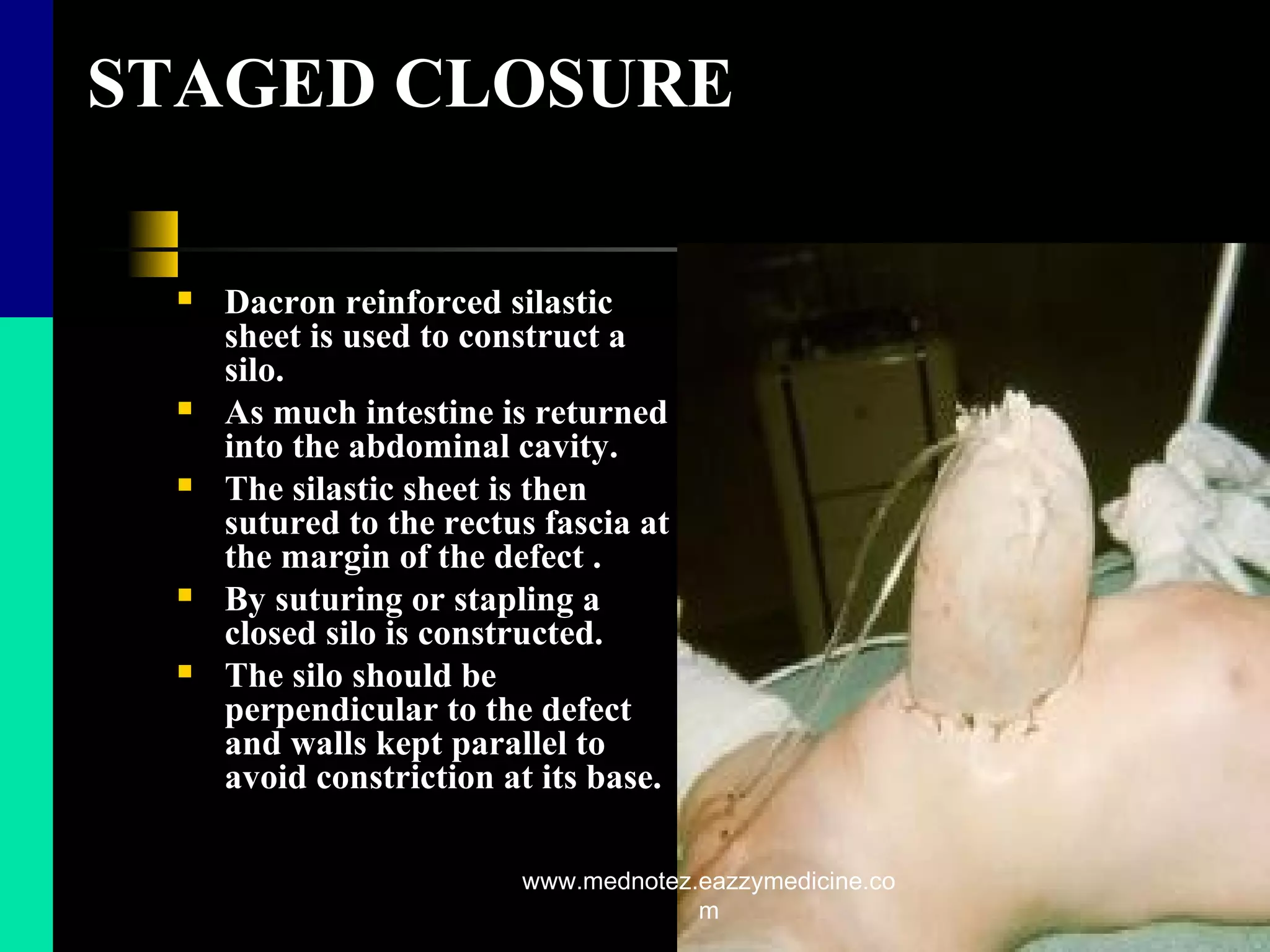 Abdominal wall defects pesantation | PPT