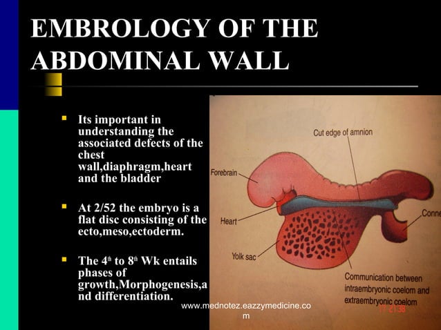 Abdominal wall defects pesantation | PPT