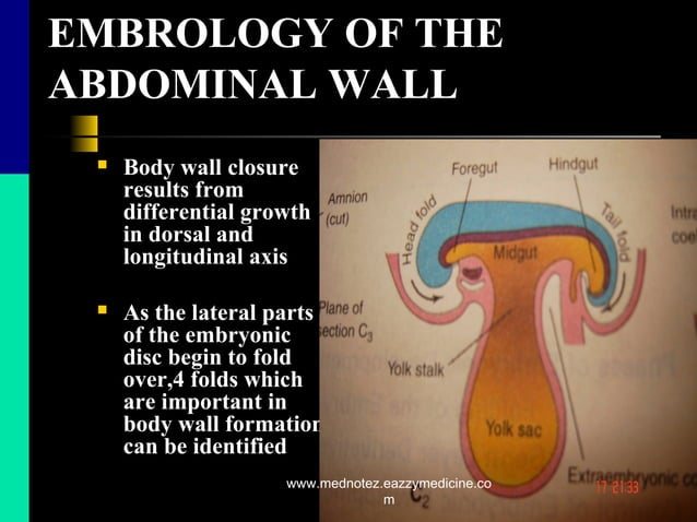 Abdominal wall defects pesantation | PPT