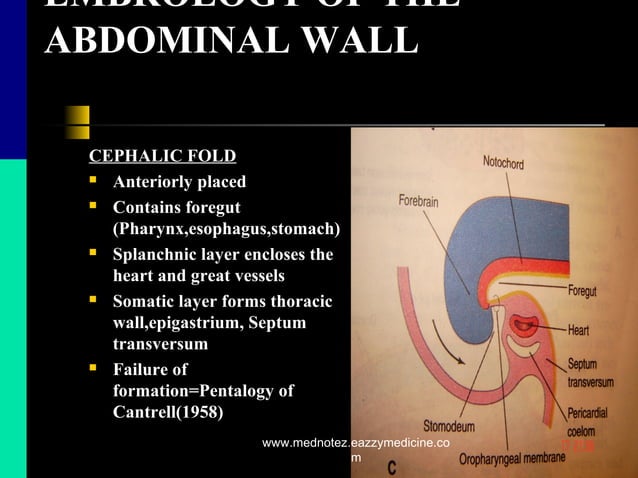 Abdominal wall defects pesantation | PPT