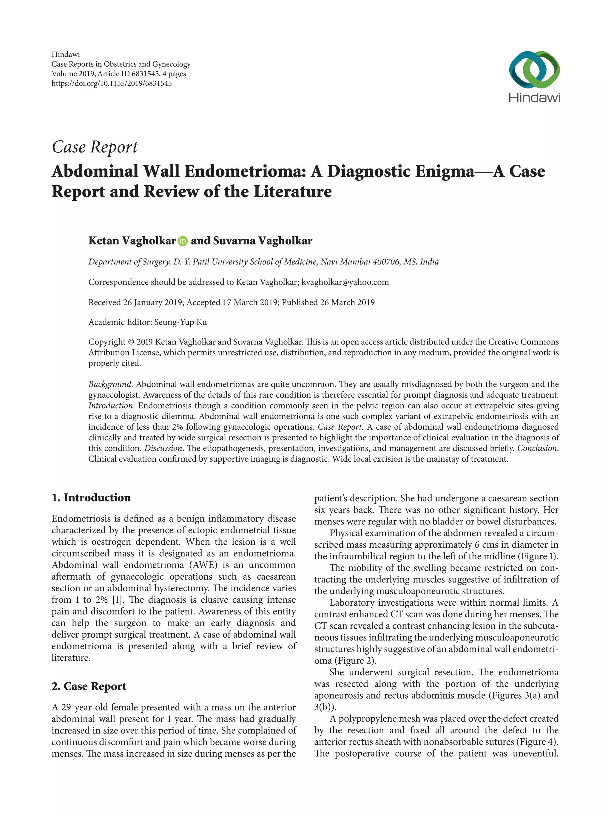 Abdominal Wall Endometrioma: A Diagnostic Enigma—A Case Report and ...