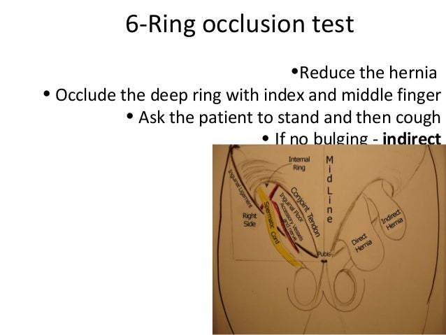 Abdominal wall herniae