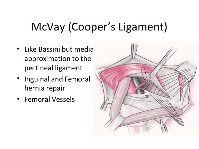 Abdominal wall herniae