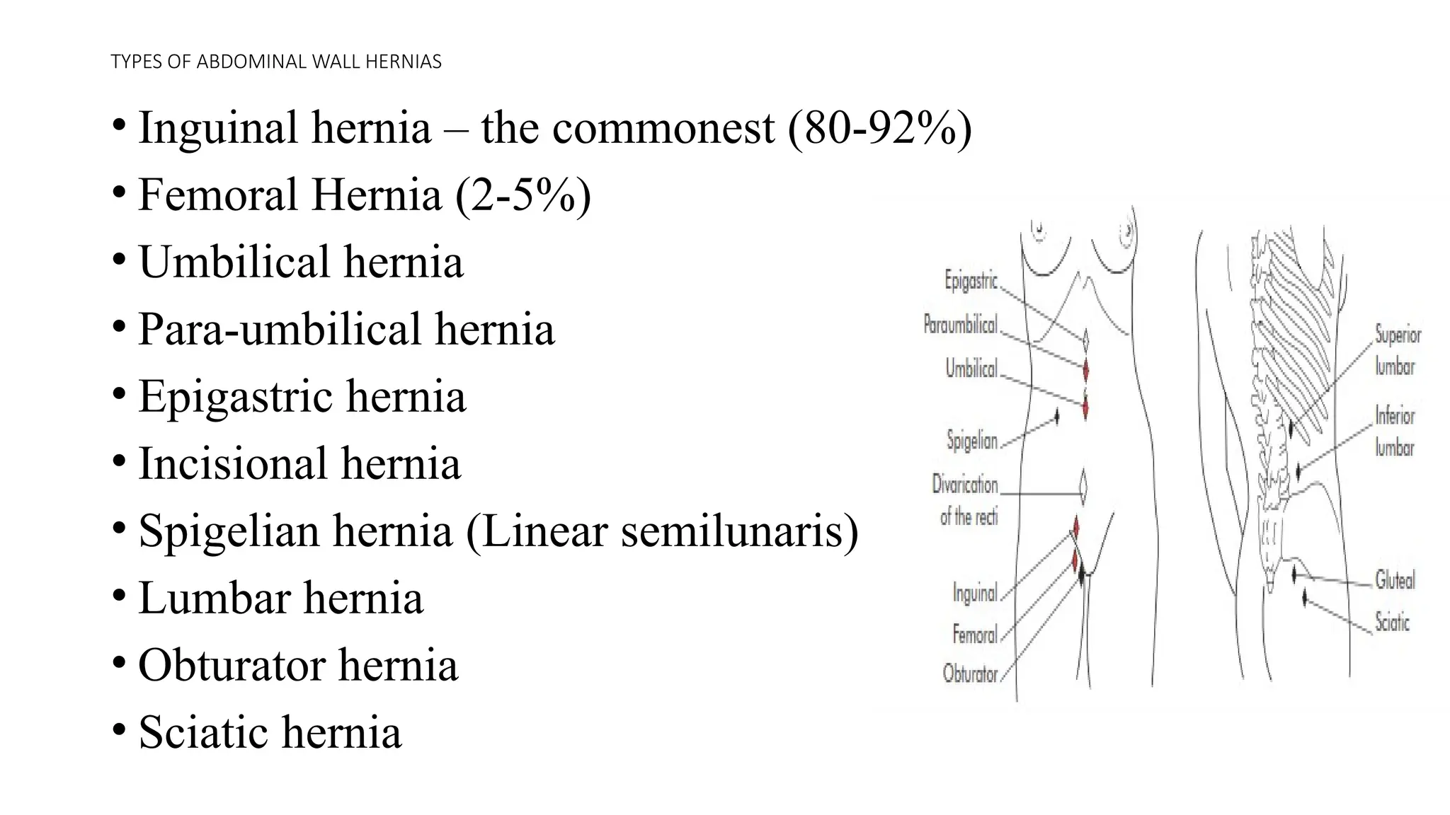 GENERAL OVERVIEW OF ABDOMINAL WALL HERNIAS.pptx