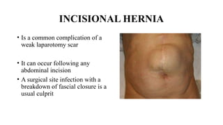 GENERAL OVERVIEW OF ABDOMINAL WALL HERNIAS.pptx