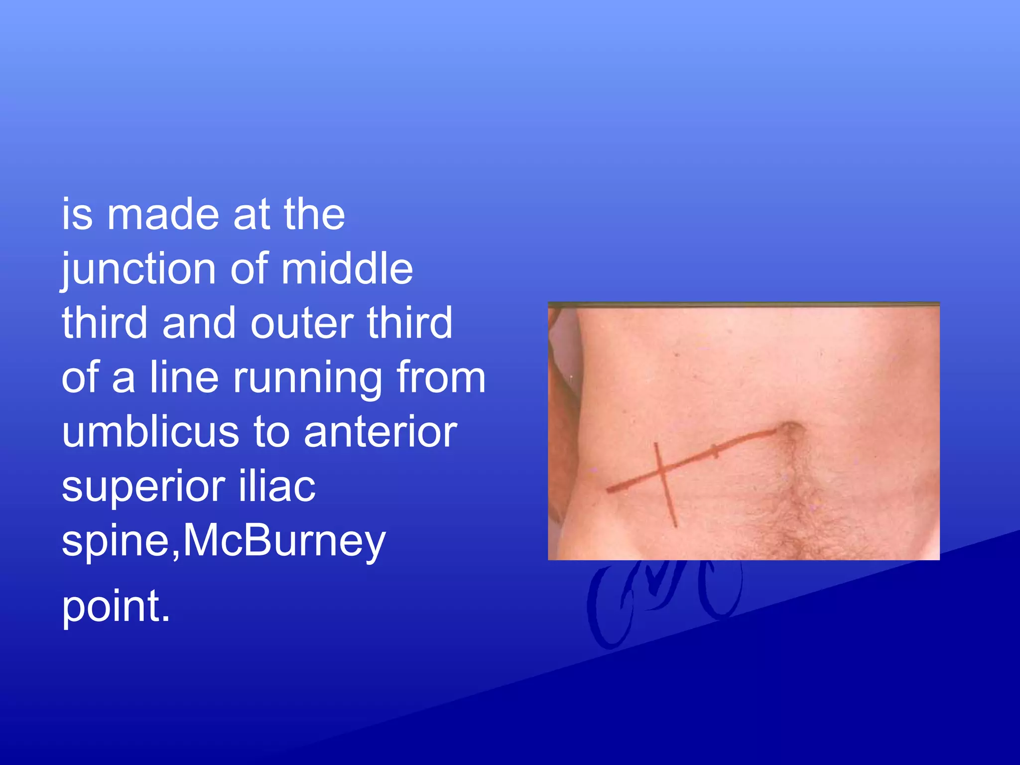 Abdominal wall incision | PPT