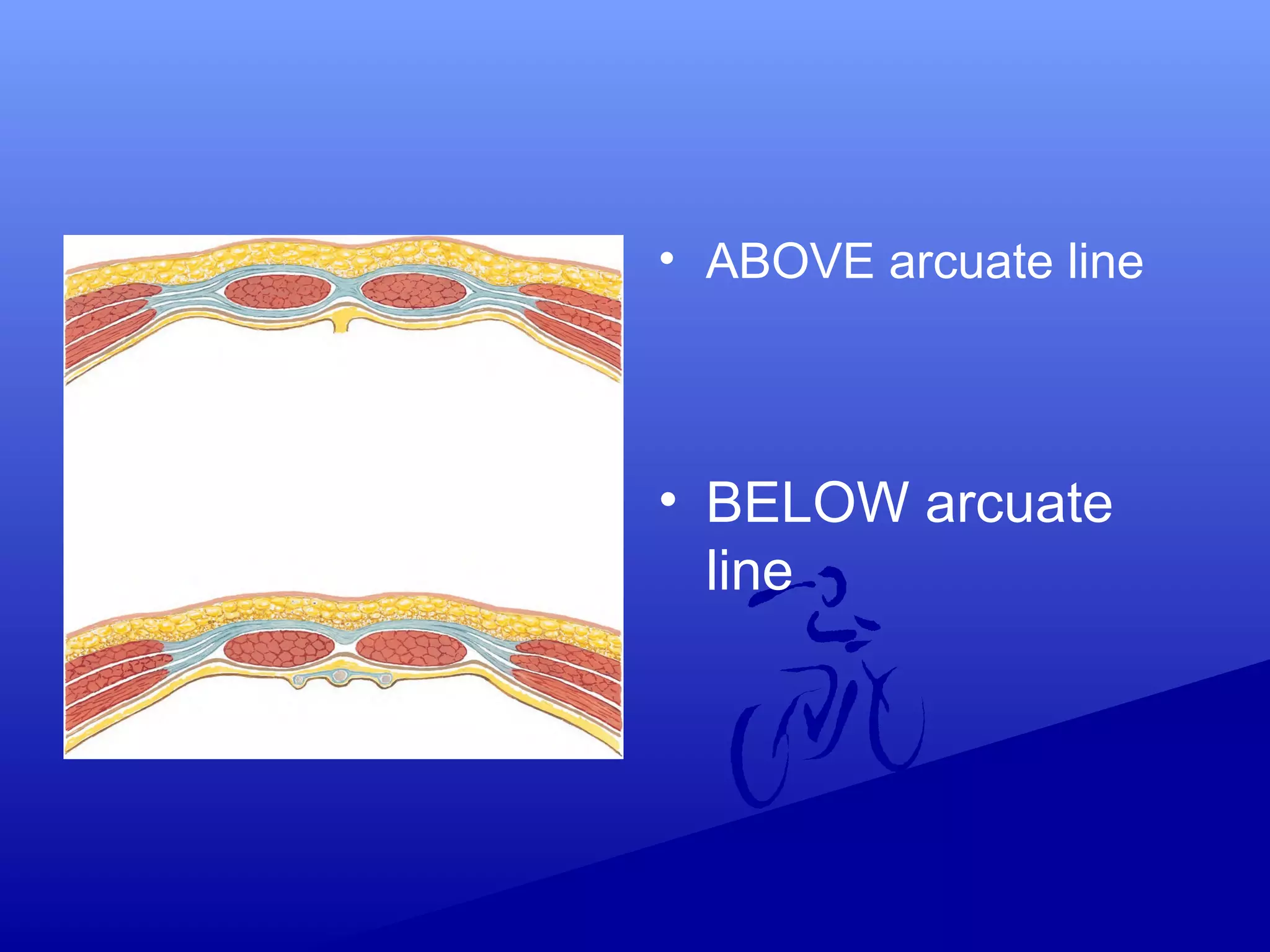 Abdominal wall incision | PPT