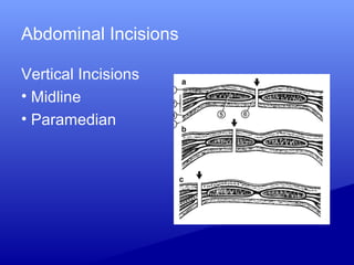 Abdominal wall incision | PPT
