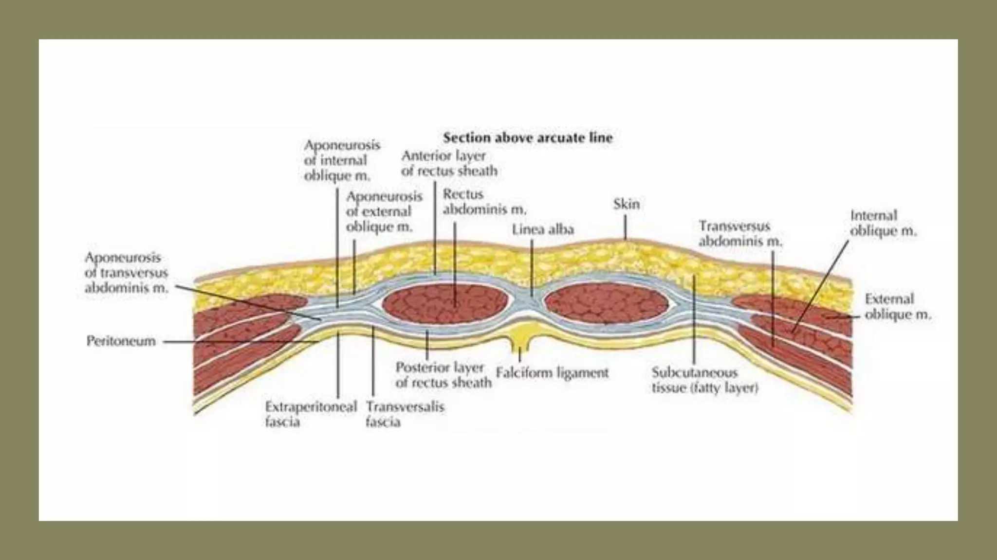 Abdominal wall incisions.pptx