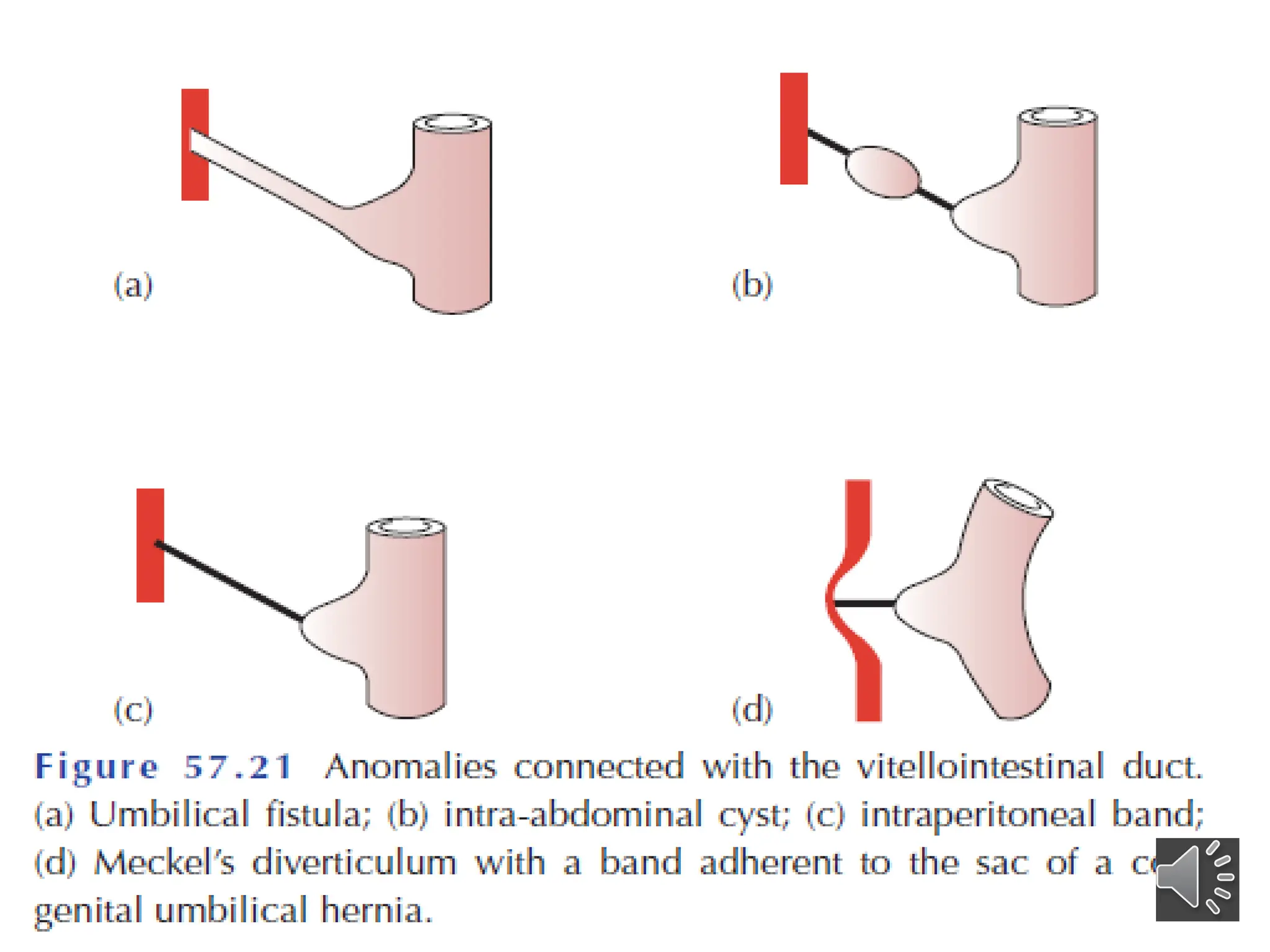Abdominal wall incisions and Umbilicus (2).pptx