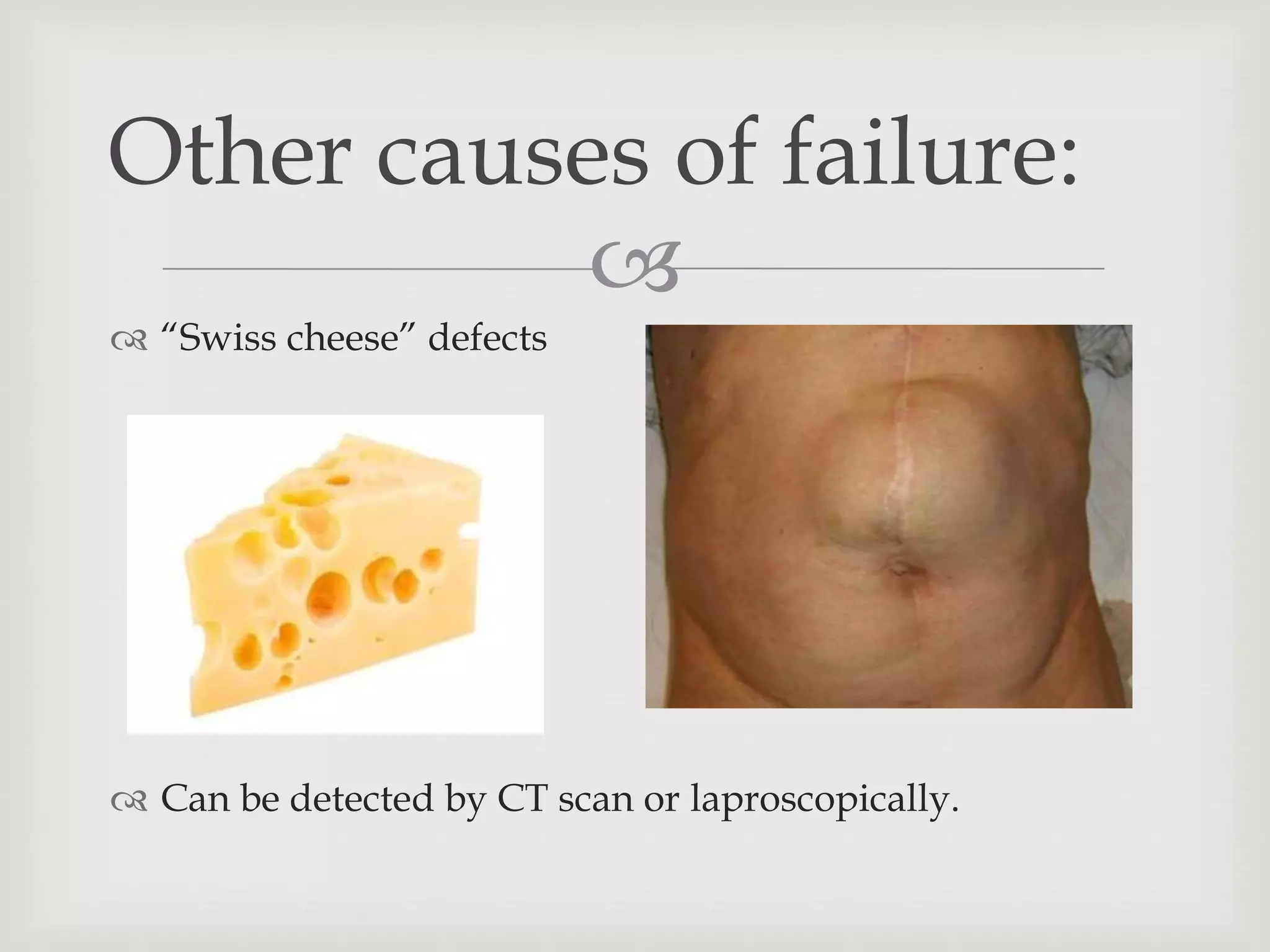 Abdominal wall Reconstruction.pptx