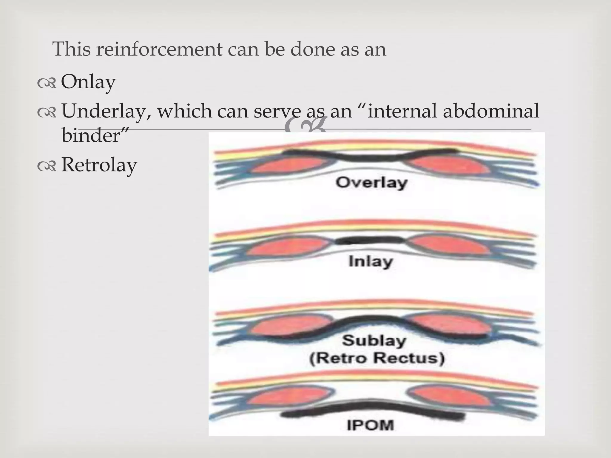 Abdominal wall Reconstruction.pptx