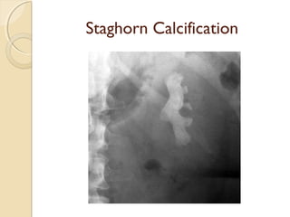 Abdominal x ray | PPT | Digestive Disorders | Diseases and Conditions